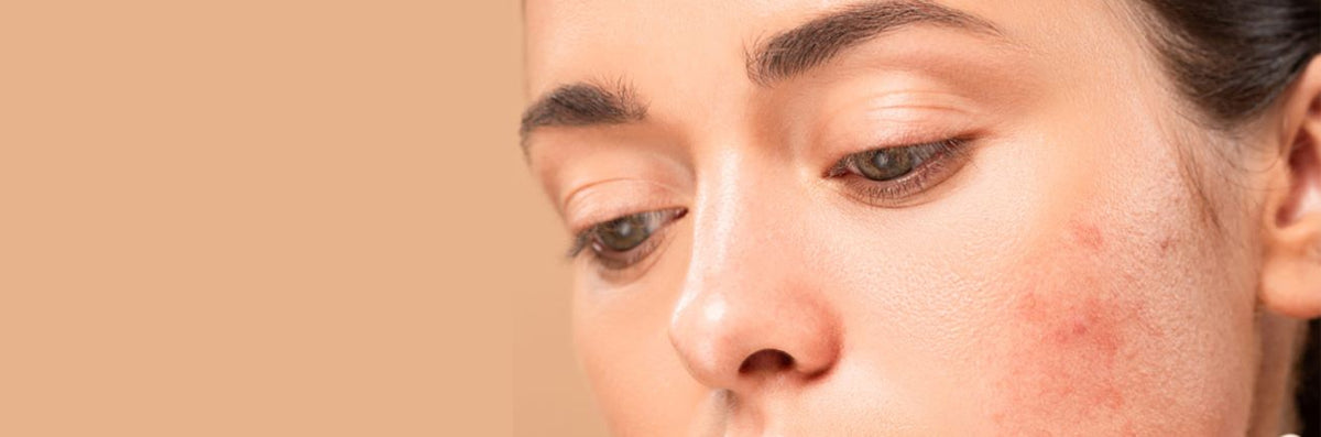 The 'How' & 'Why' of layering acids in your skincare routine effectively