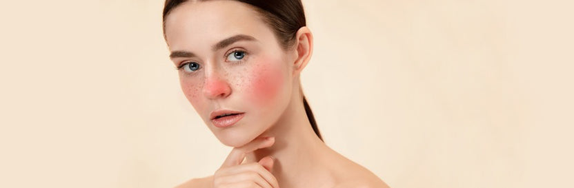 Dont Ignore That Itch Complete Itchy Scalp Prevention And Care