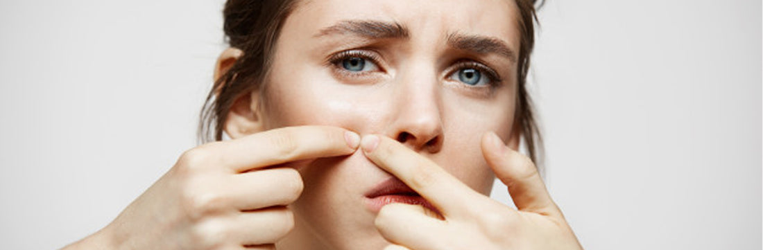 Whiteheads: Getting to the pore of the problem